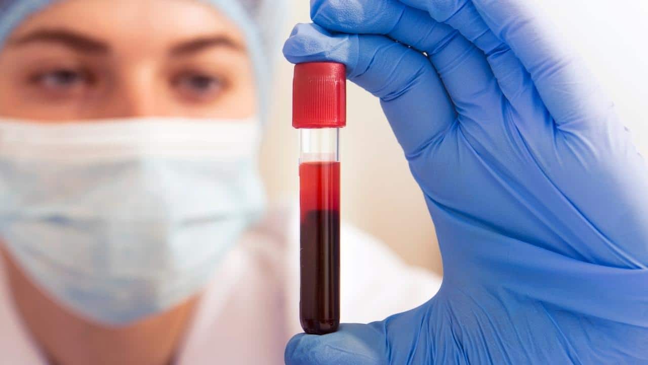 שירותים מתקדמים עבור בדיקות דם - Human Test-כל הבדיקות במקום אחד