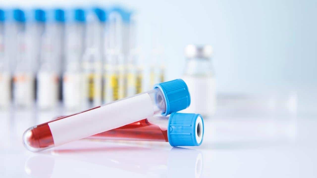 בדיקות דם יום שישי | Human-Test: בדיקות דם ביום שישי לכל מטרה