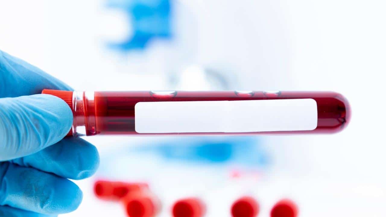 בדיקת מתכות כבדות בדם: Human-Test - מכשור מתקדם וחדשני