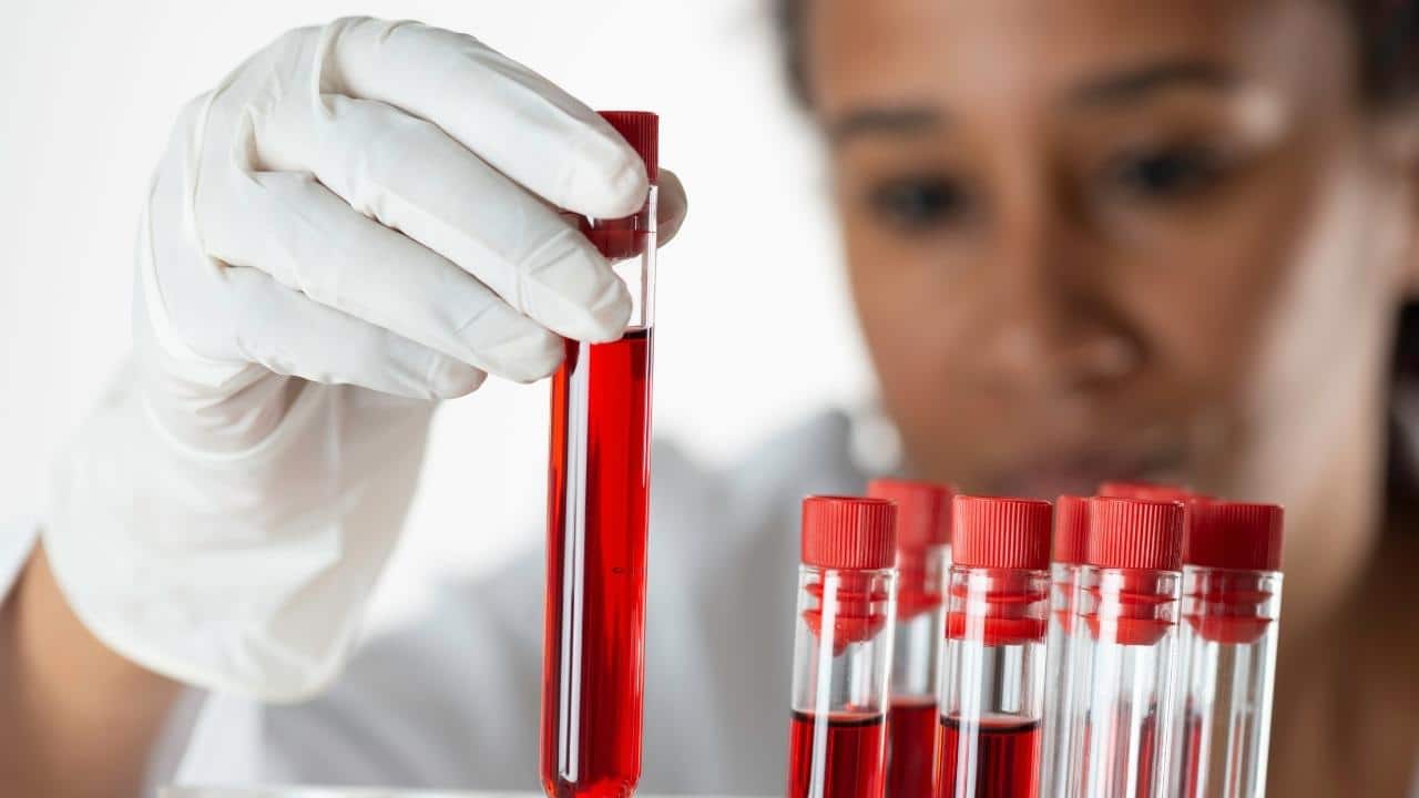 Blood test - Human Test - all the tests in one place